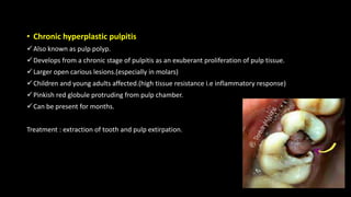 pulpal and periapical lesions.pptx