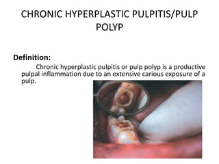 Pulpal diseases | PPTX