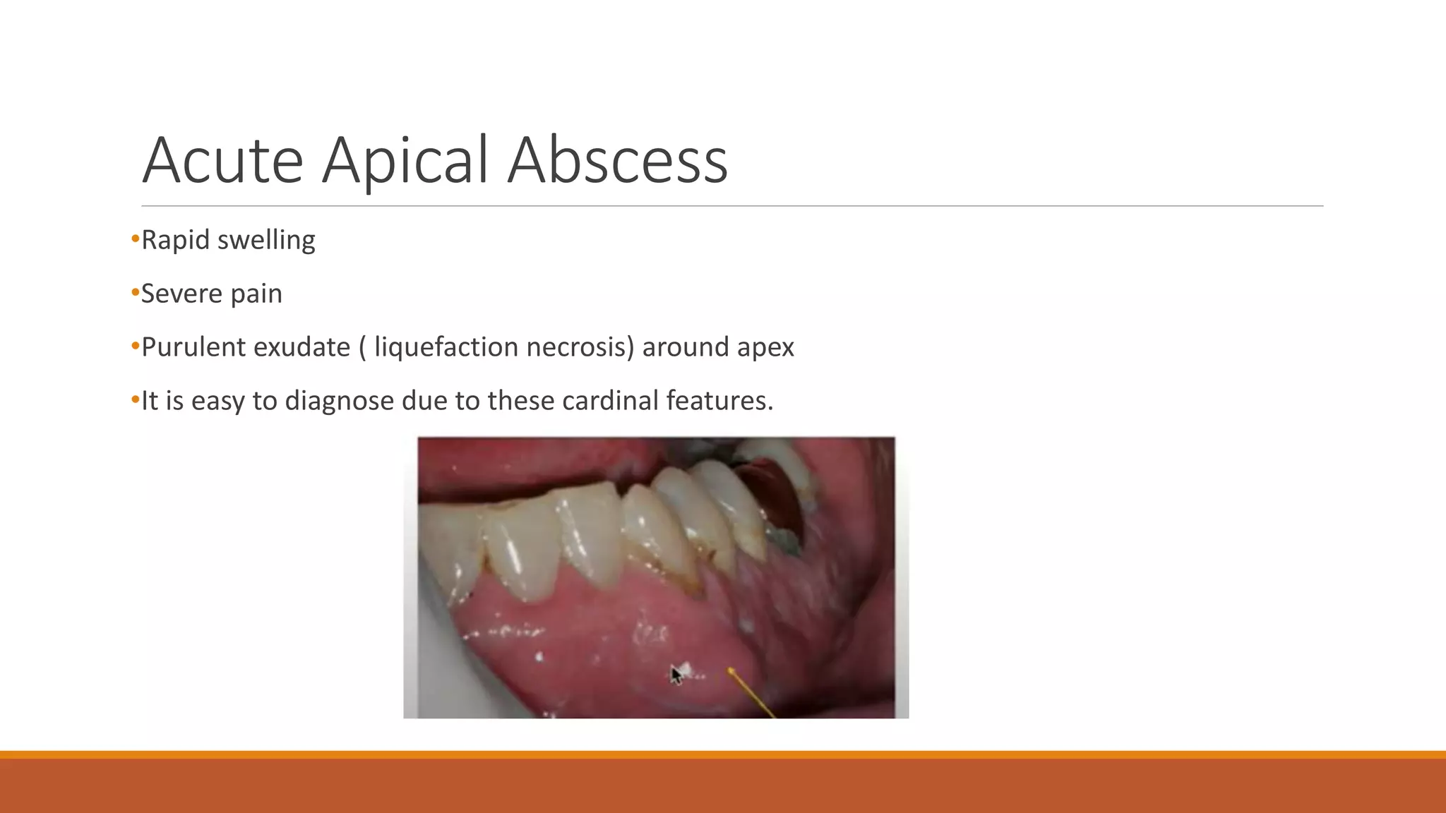 Pulpal & PeriApical Diagnosis.pptx