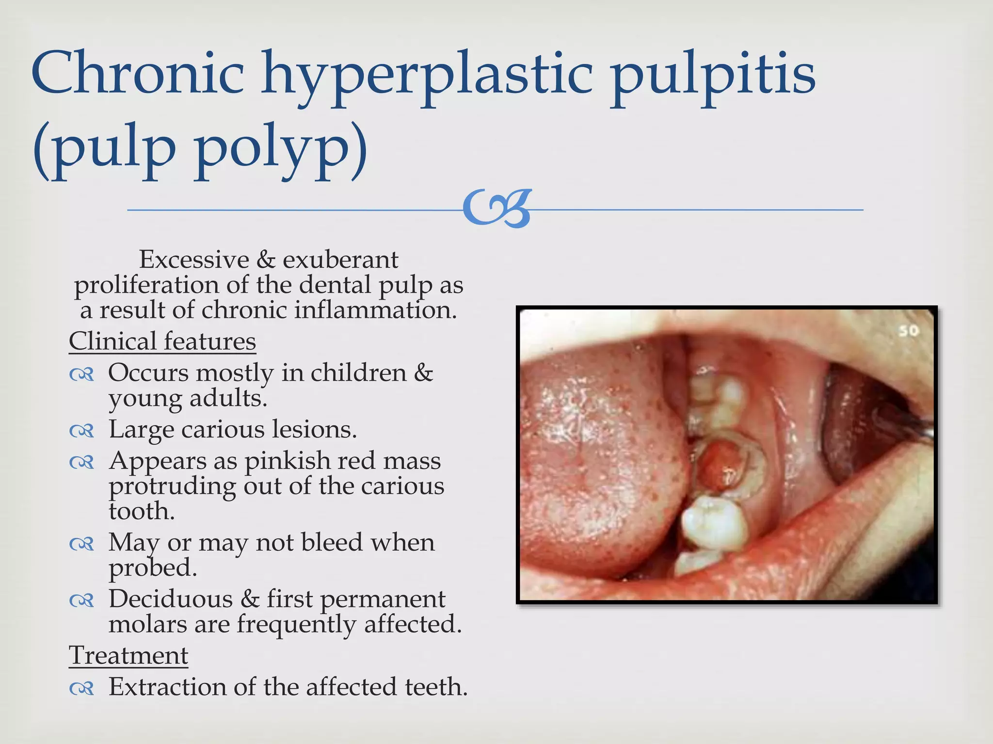 Pulpal & periapical diseases | PPTX
