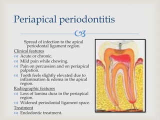 Pulpal & periapical diseases | PPTX
