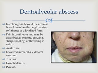 Pulpal & periapical diseases | PPTX