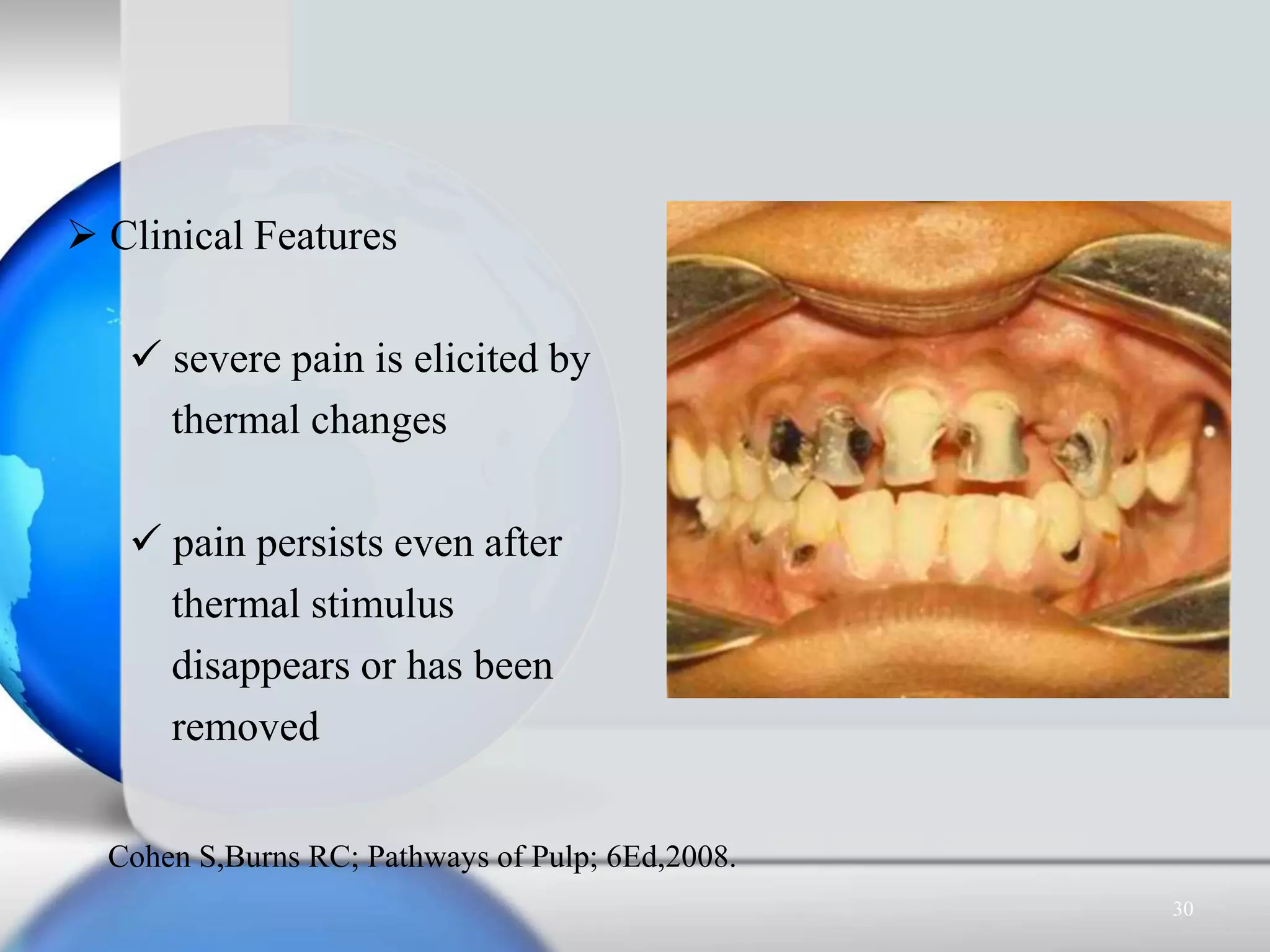 Pulpal & periradicular diseases & their diagnosis | PPTX