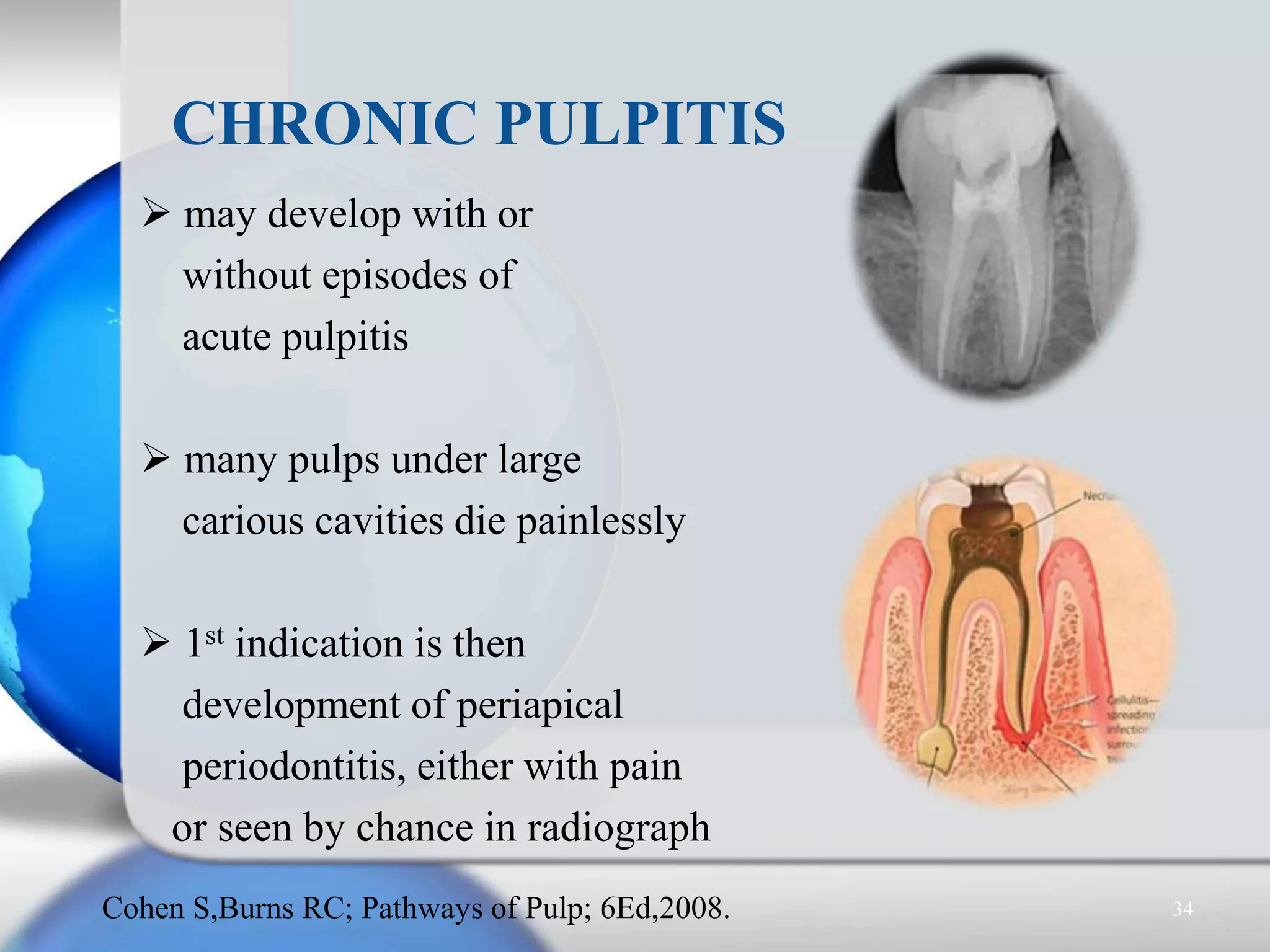 Pulpal & periradicular diseases & their diagnosis | PPTX