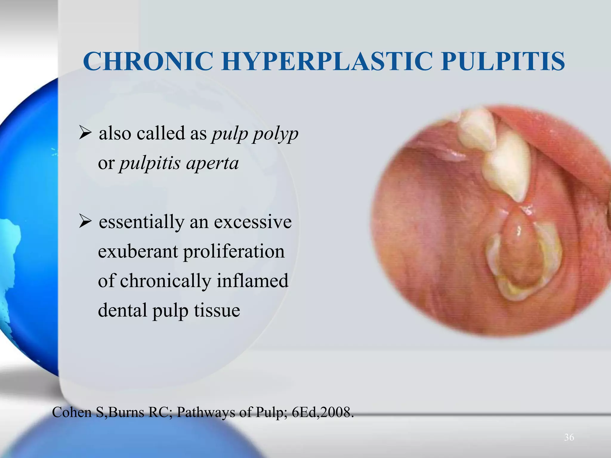 Pulpal & periradicular diseases & their diagnosis | PPTX