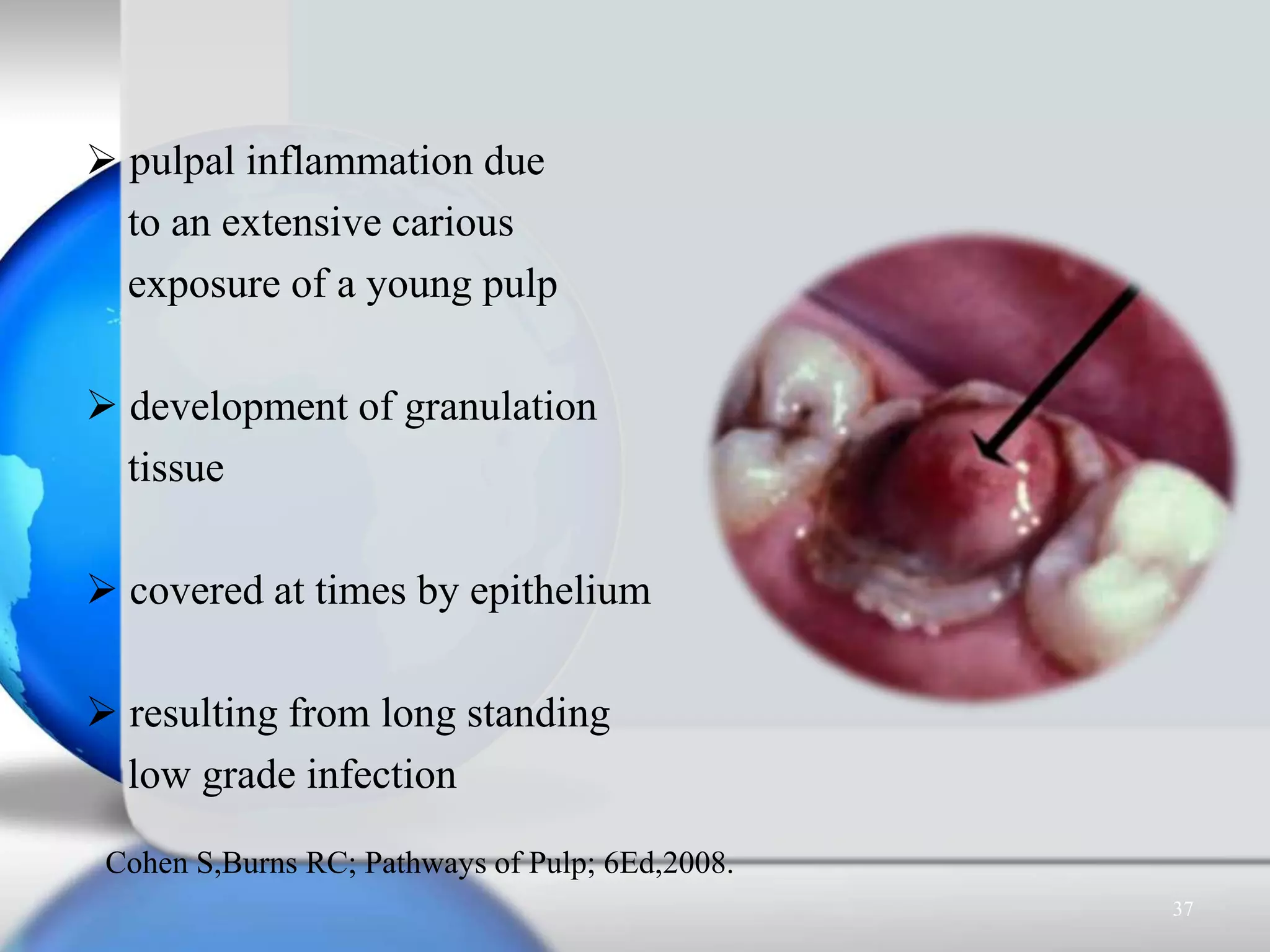 Pulpal & periradicular diseases & their diagnosis | PPTX