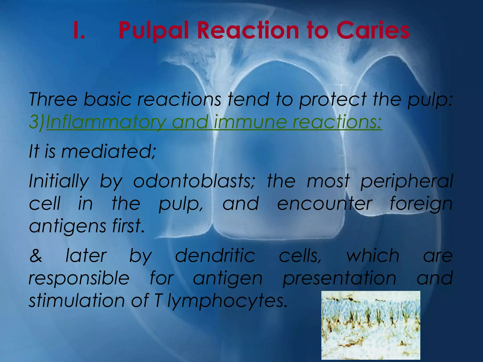 Pulpal reactions to caries and dental procedures | PPT