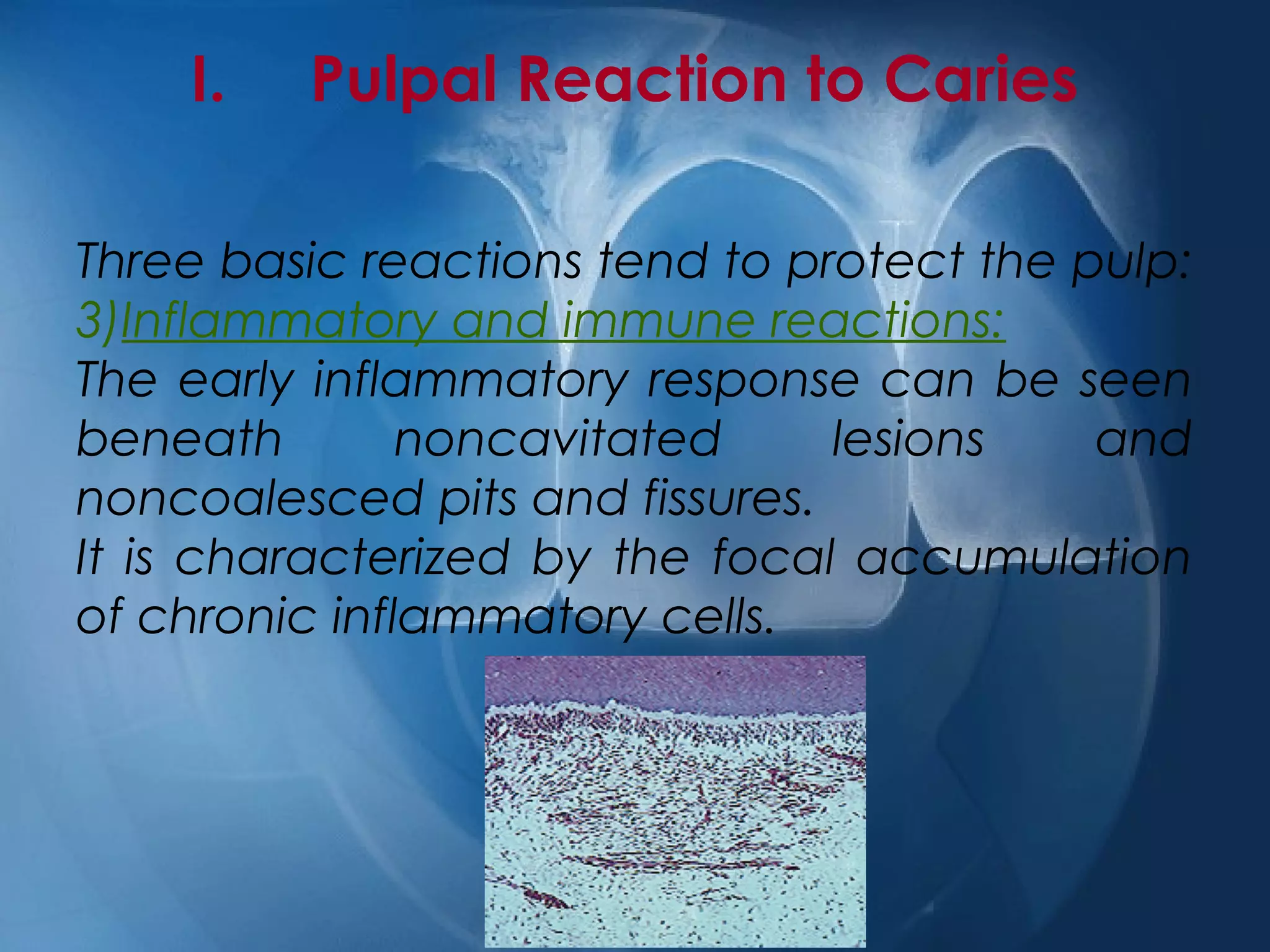 Pulpal reactions to caries and dental procedures | PPT