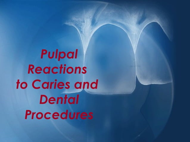 Pulpal reactions to caries and dental procedures | PPT