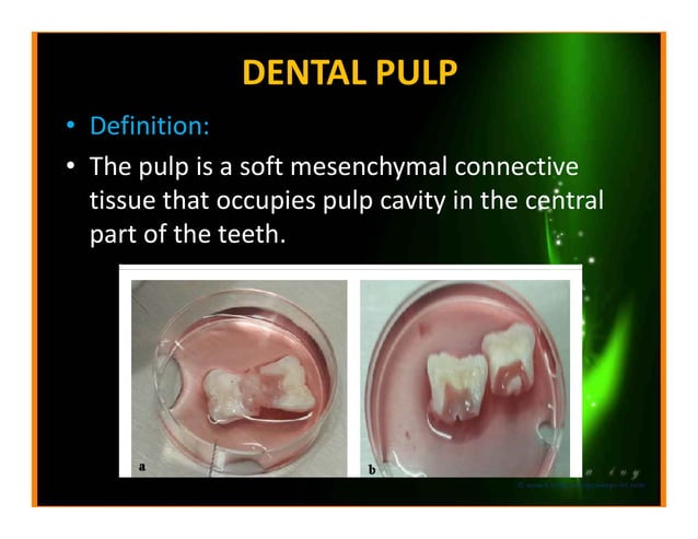 Pulpal reactions to operative procedures | PDF | Dental Health ...