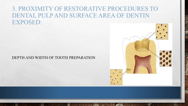 Pulpal reactions to various stimuli | PPTX