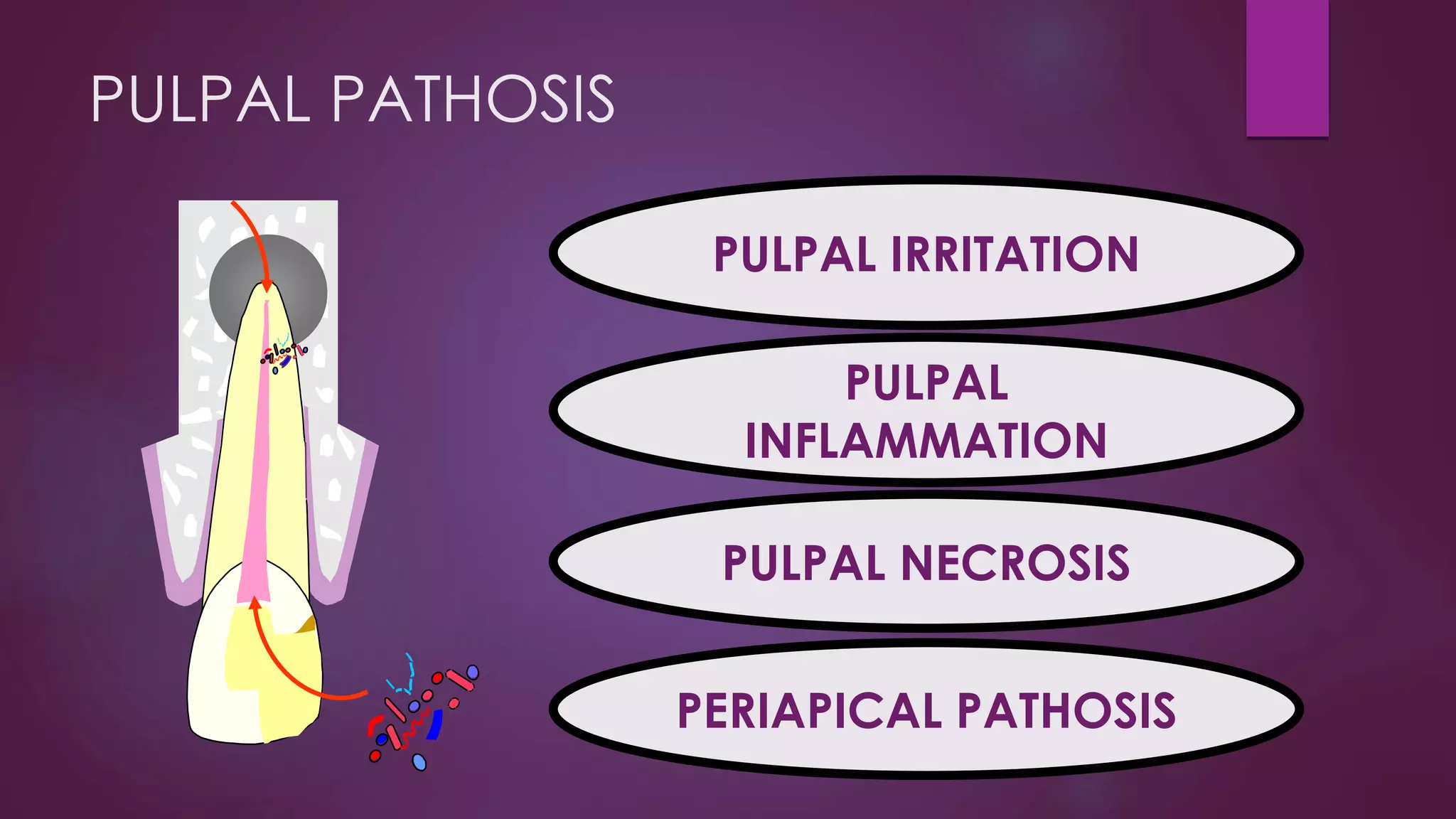 Pulp and periapical disease | PPTX