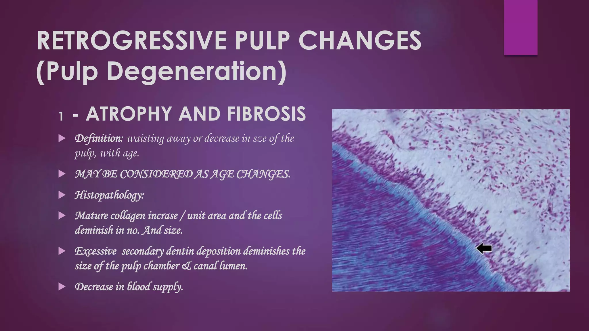 Pulp and periapical disease | PPTX