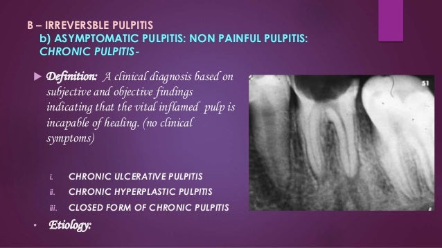 Pulp and periapical disease