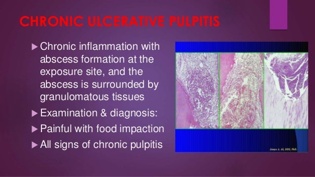 Pulp and periapical disease
