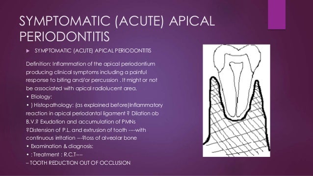 Pulp and periapical disease