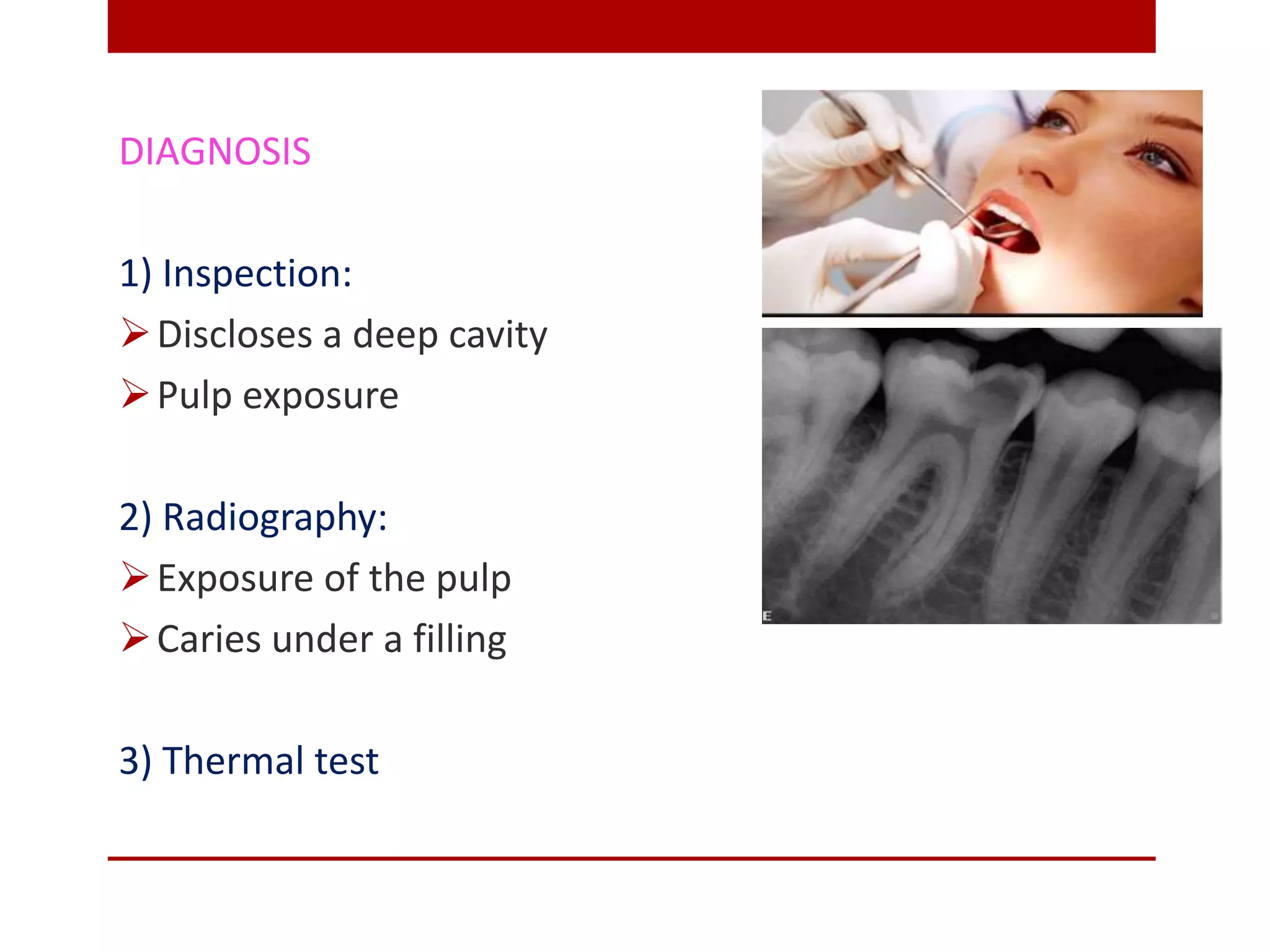PULP AND PERIAPICAL LESIONS OF THE TOOTH ppt | PPTX