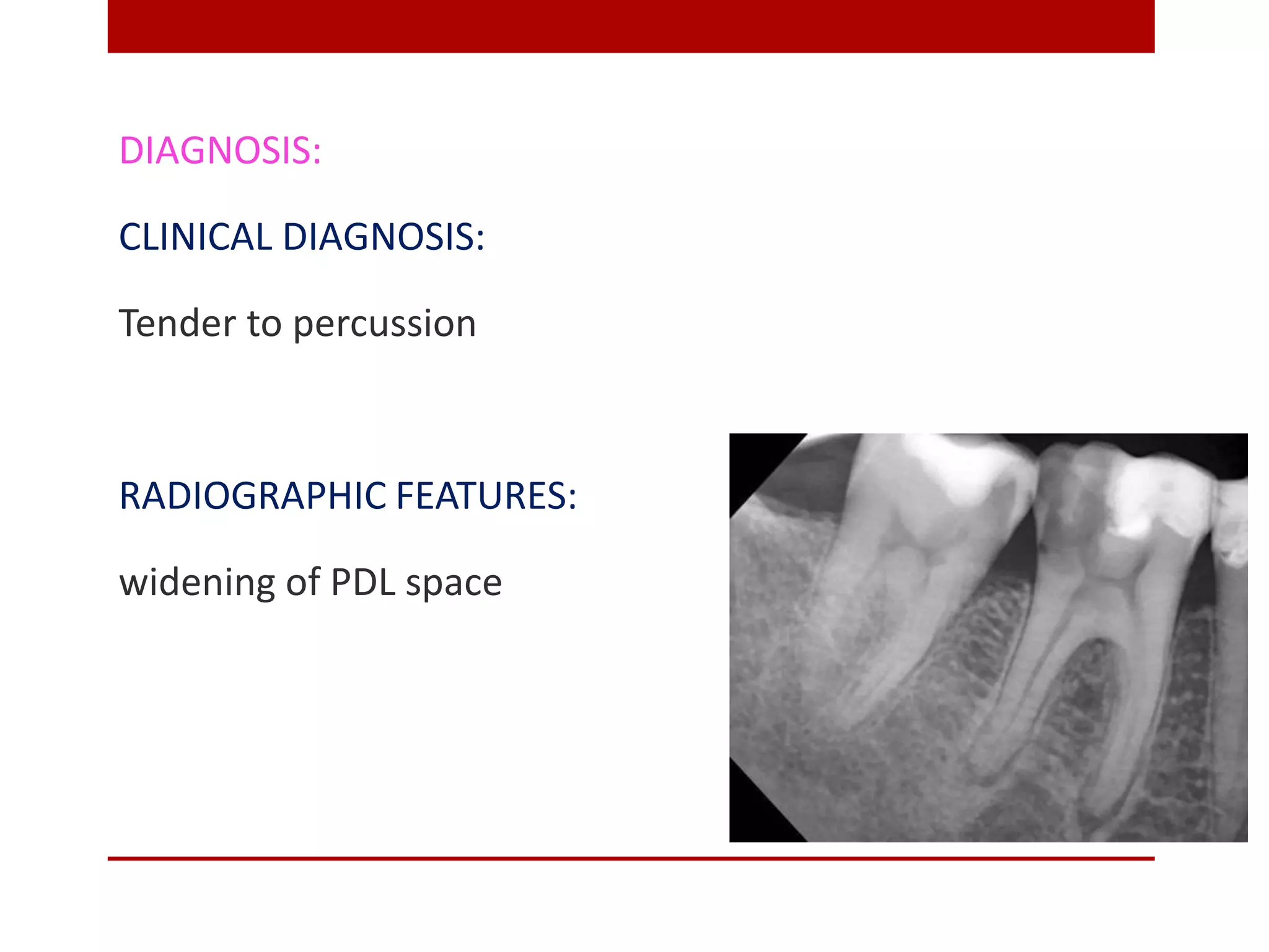 PULP AND PERIAPICAL LESIONS OF THE TOOTH ppt | PPTX