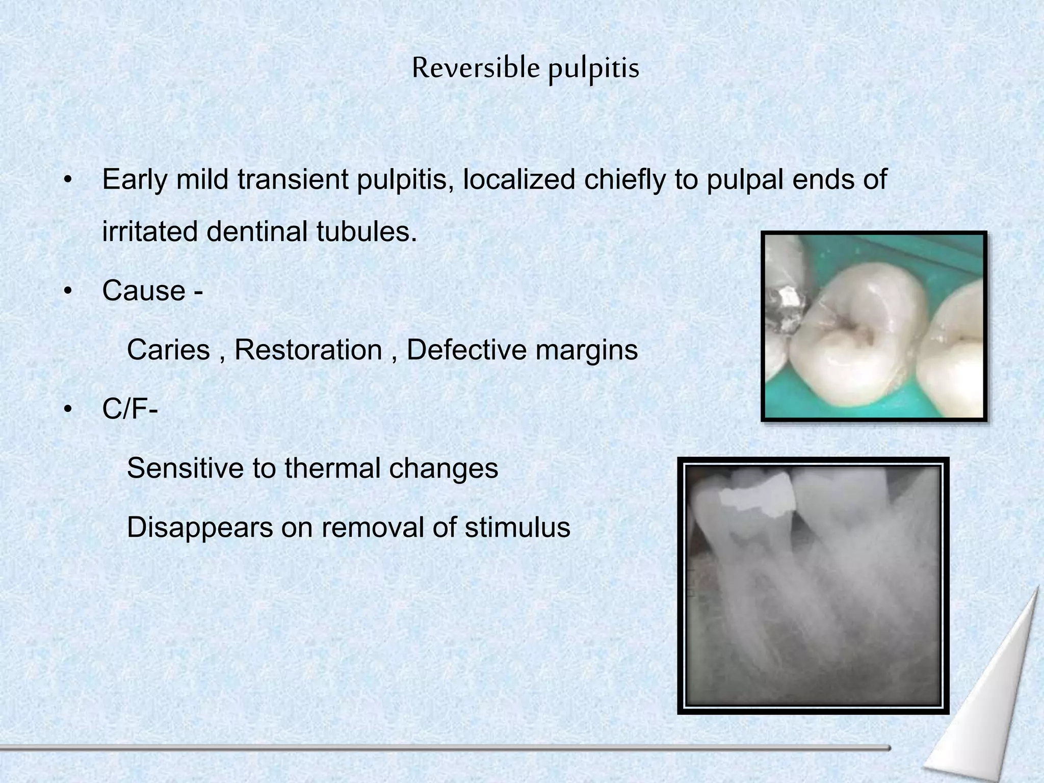 Pulp and periapical pathologies | PPTX