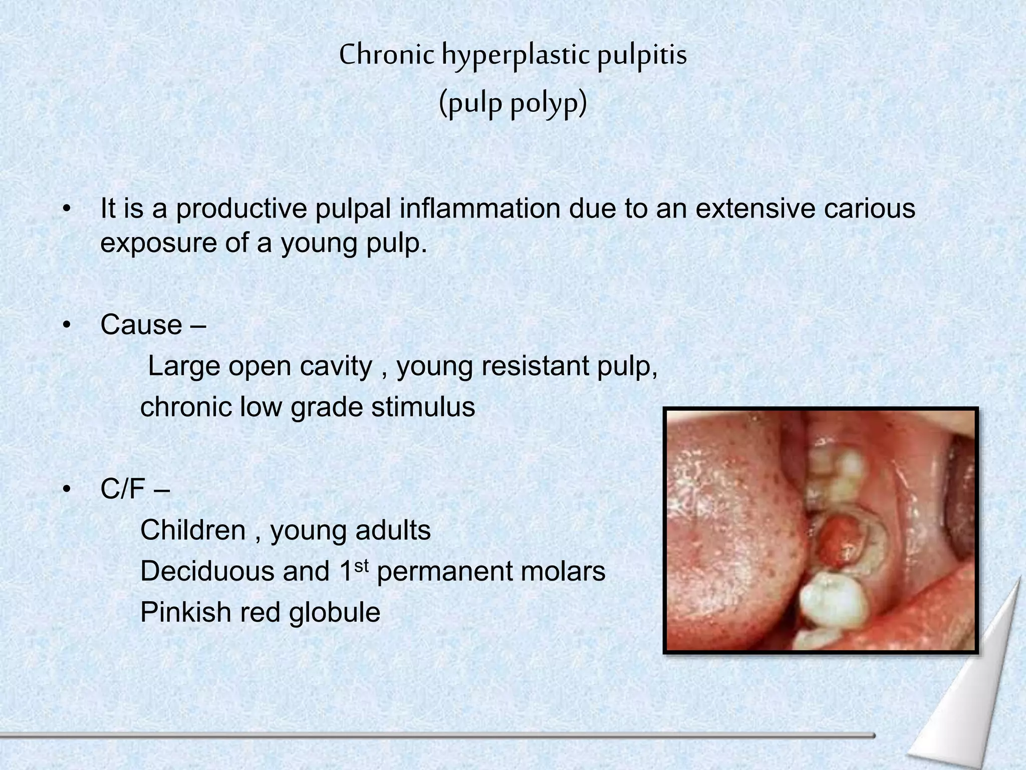 Pulp and periapical pathologies | PPTX