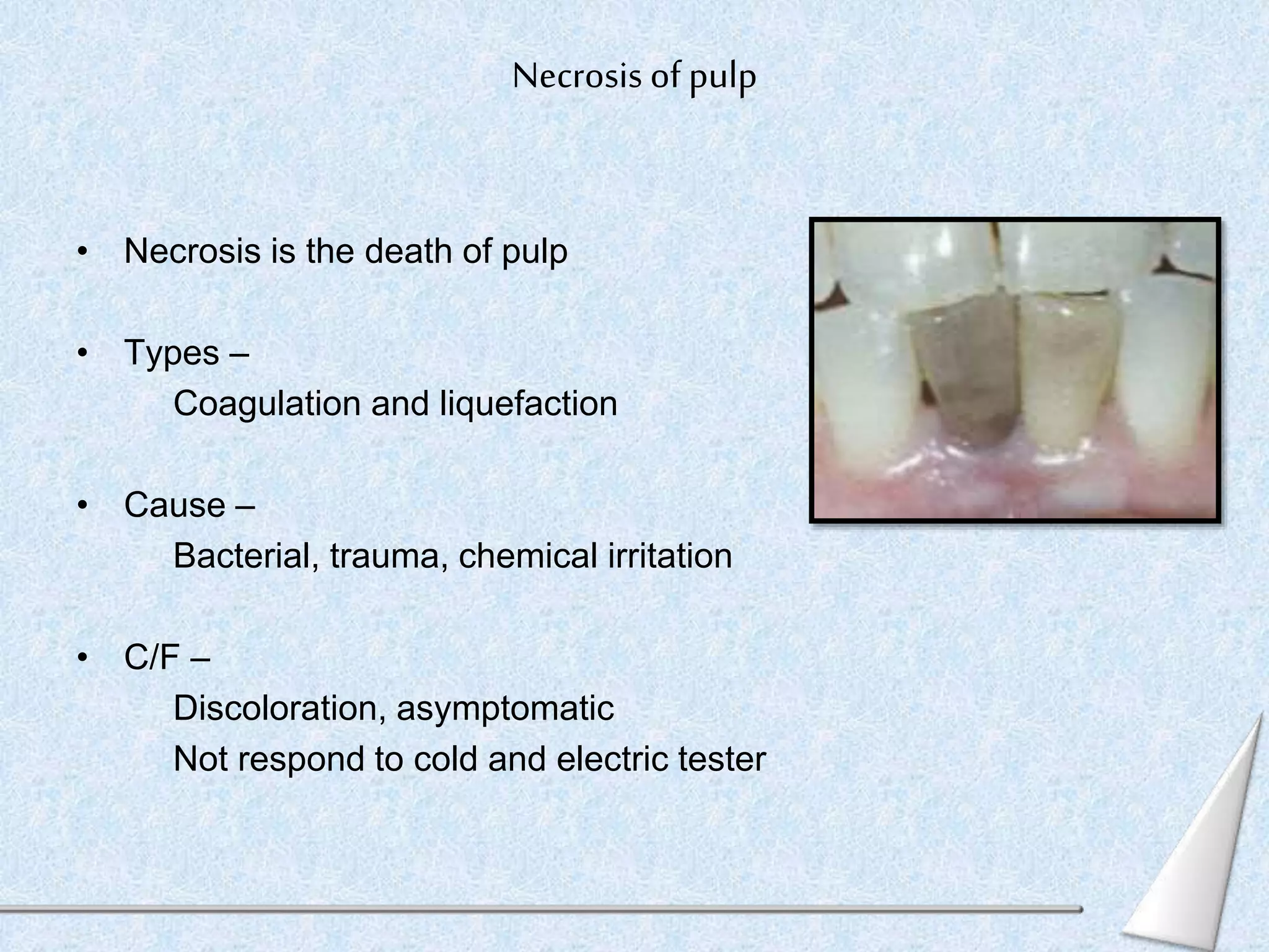 Pulp and periapical pathologies | PPTX