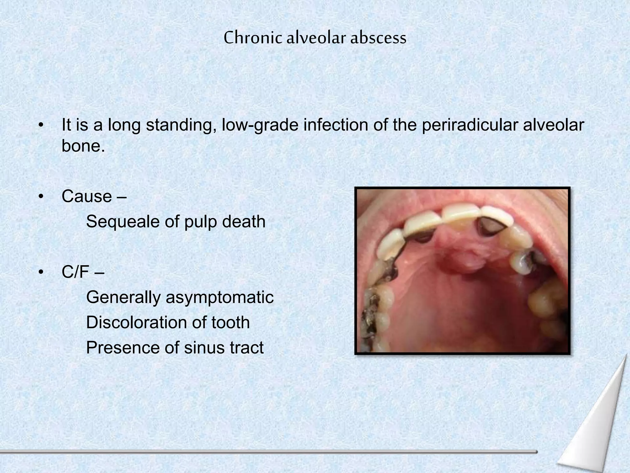 Pulp and periapical pathologies | PPTX