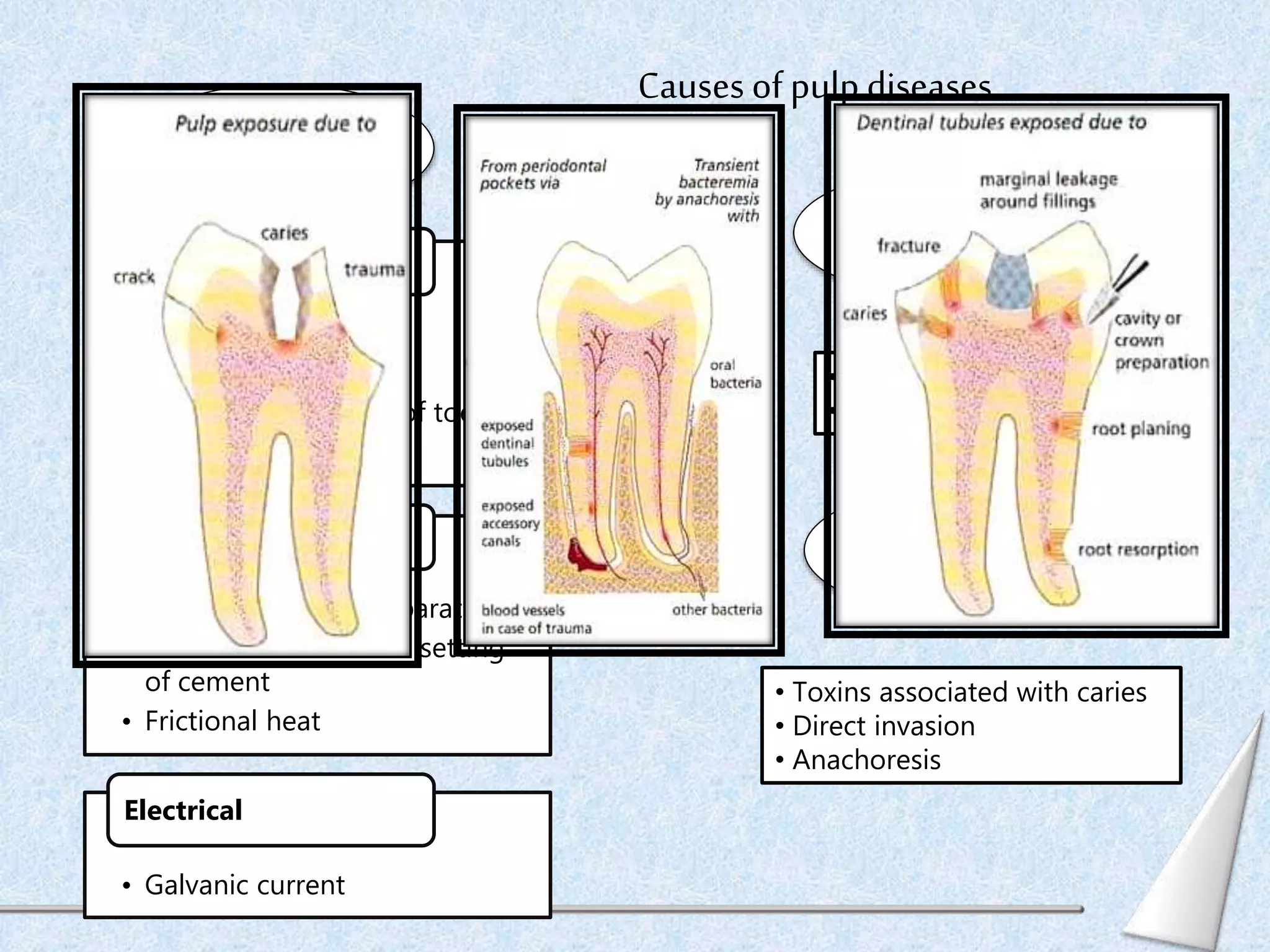 Pulp and periapical pathologies | PPTX