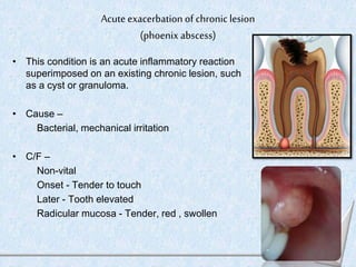 Pulp and periapical pathologies | PPTX