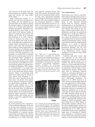 Pulpa y perio | PDF