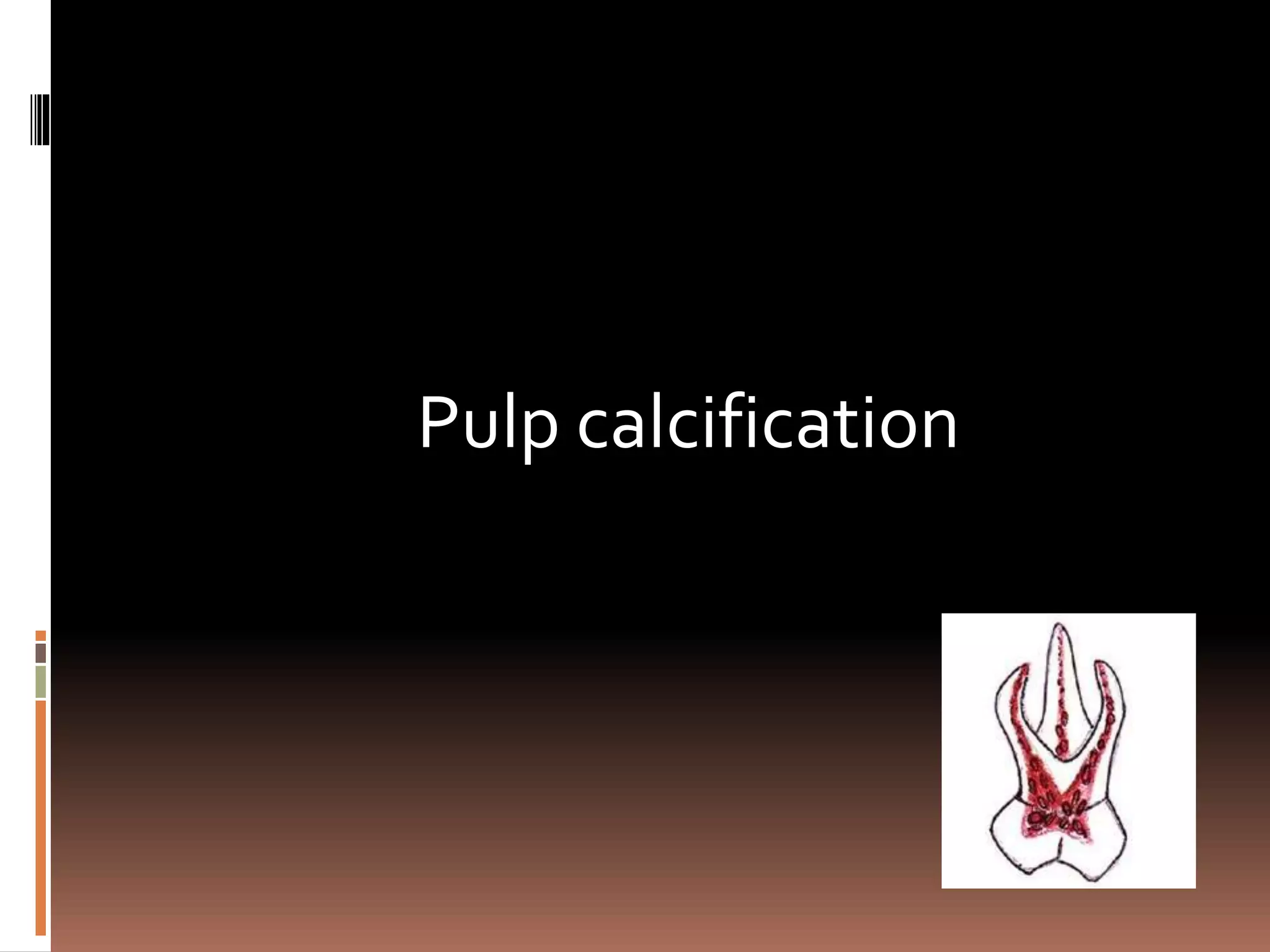 Pulp calcification | PPTX