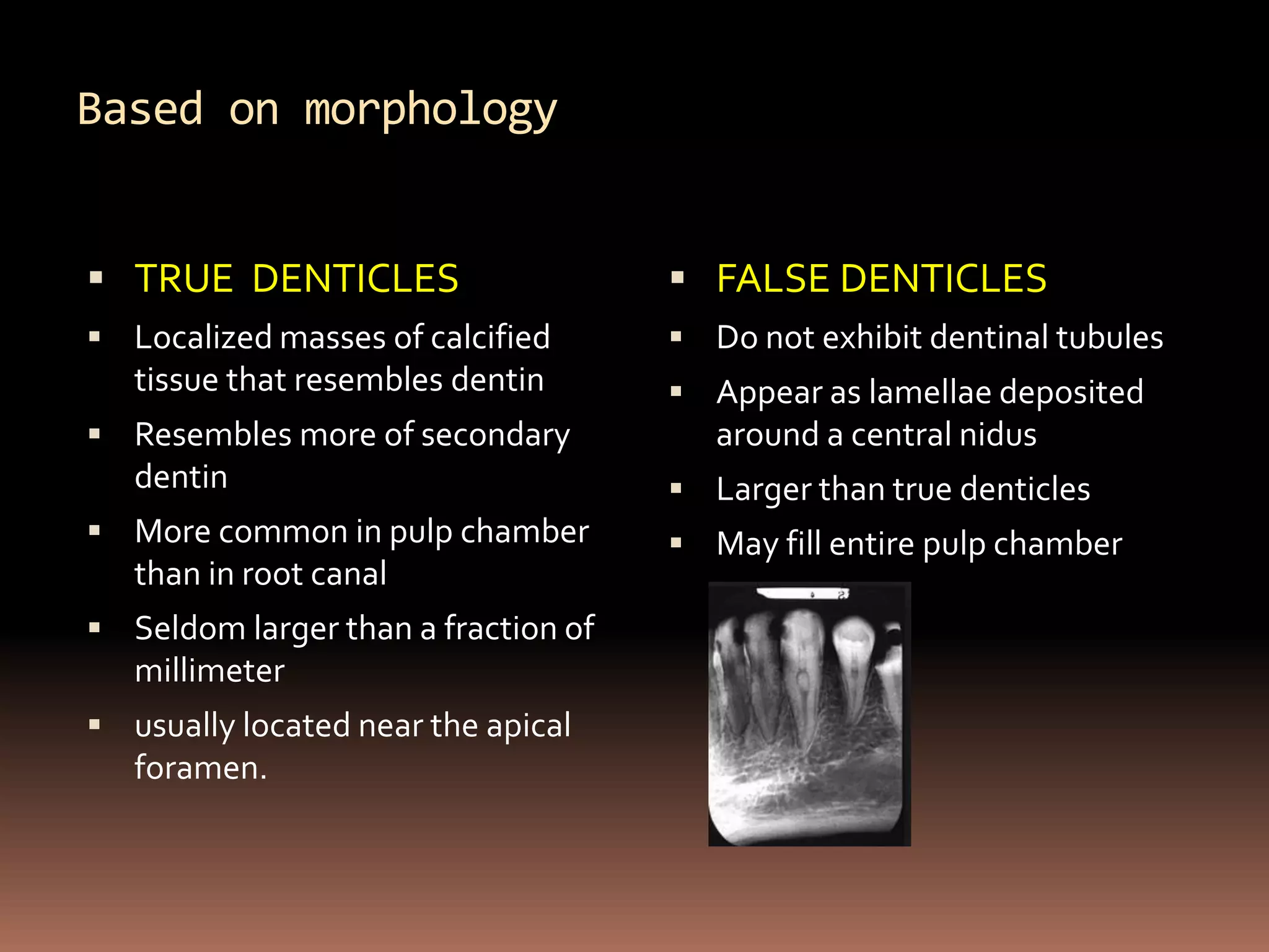 Pulp calcification | PPTX