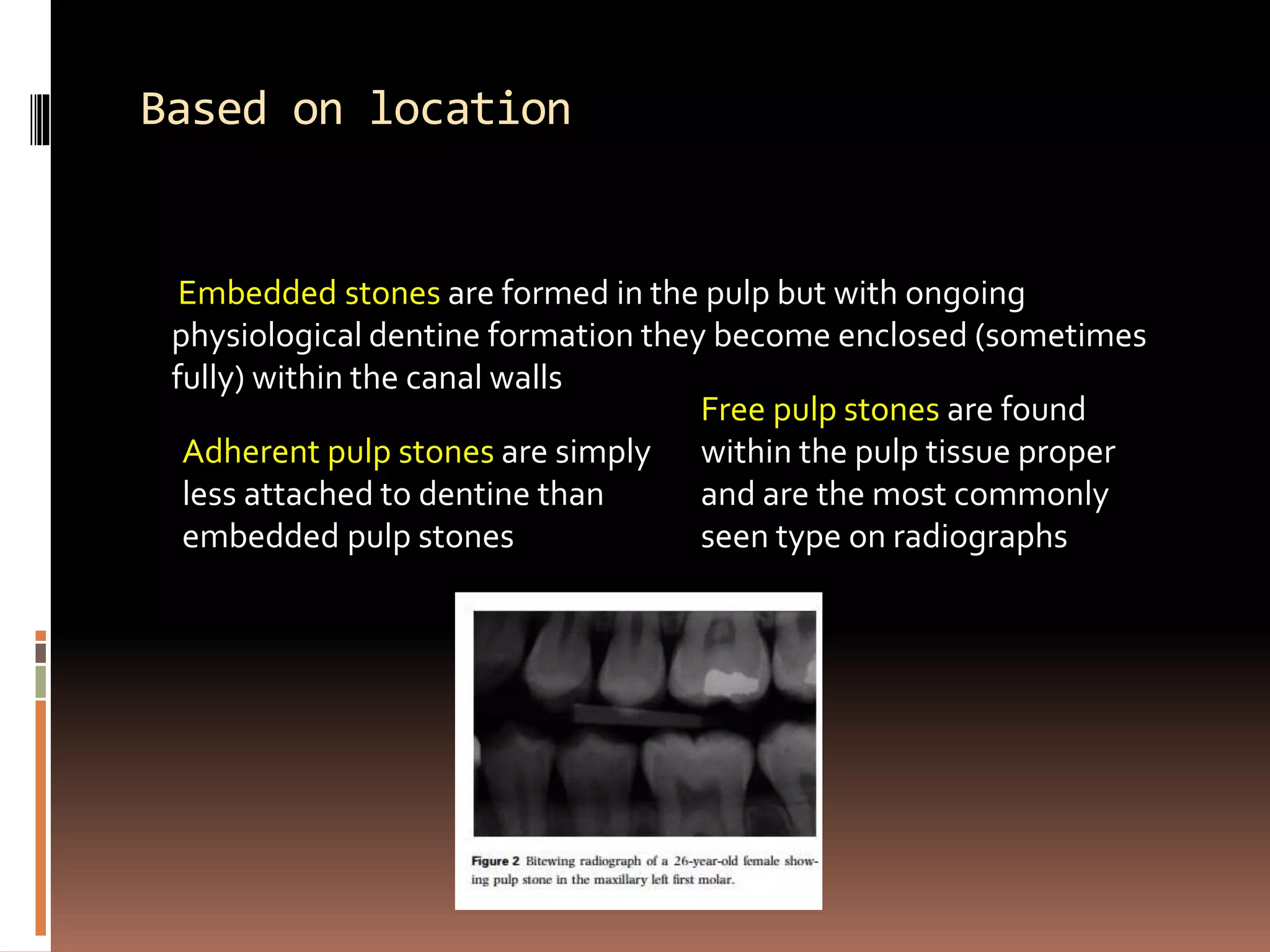 Pulp calcification | PPTX