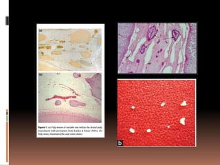 Pulp calcification | PPTX
