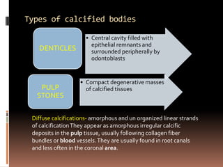 Pulp calcification | PPTX