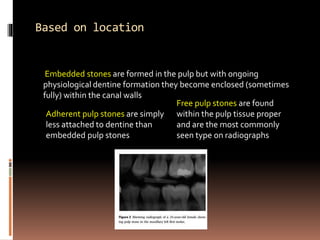 Pulp calcification | PPTX