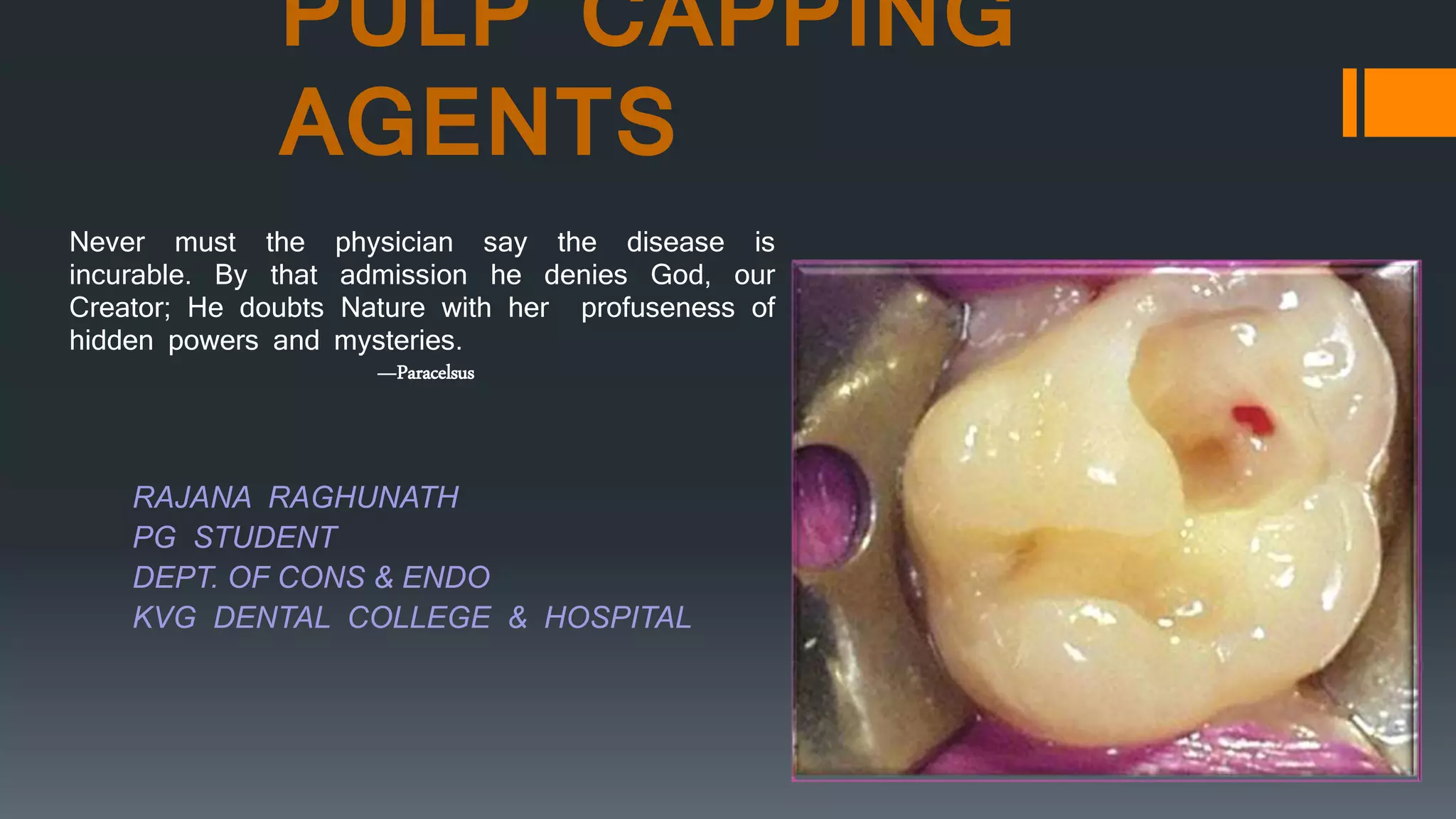 Pulp capping agents | PPTX