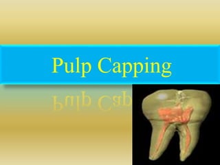 Pulp capping and pulp capping agents | PPTX