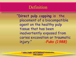 Pulp capping and pulp capping agents | PPTX