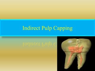 Pulp capping and pulp capping agents | PPT