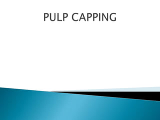 Pulp capping fix | PPTX