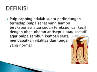 Pulp capping fix | PPTX