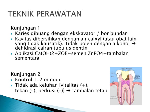 Pulp capping fix | PPTX