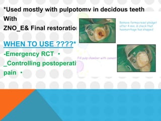 Pulp capping materials | PPTX