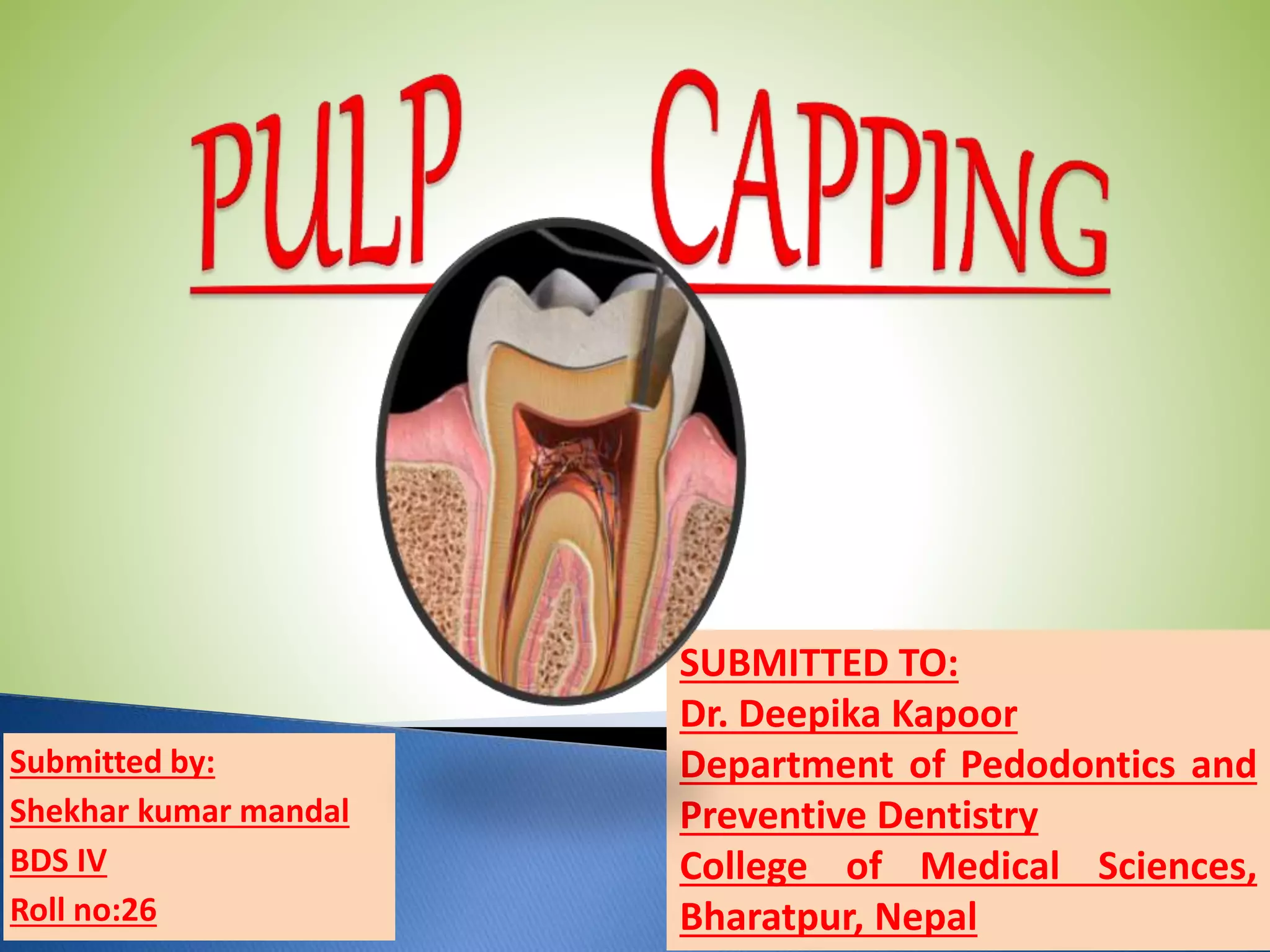 Pulp capping | PPTX