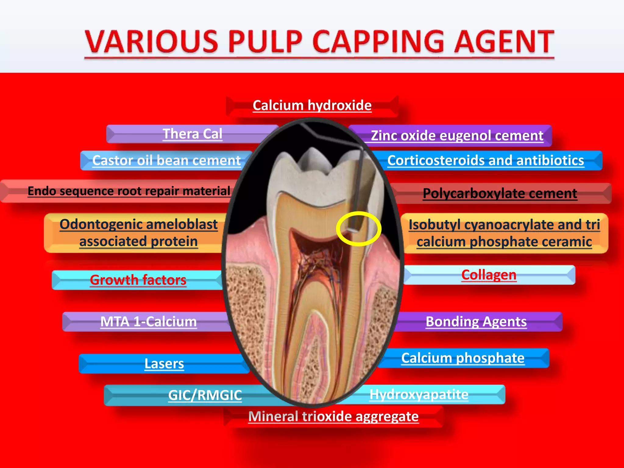 Pulp capping | PPTX