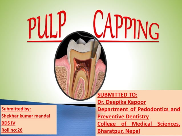 Pulp capping | PPTX