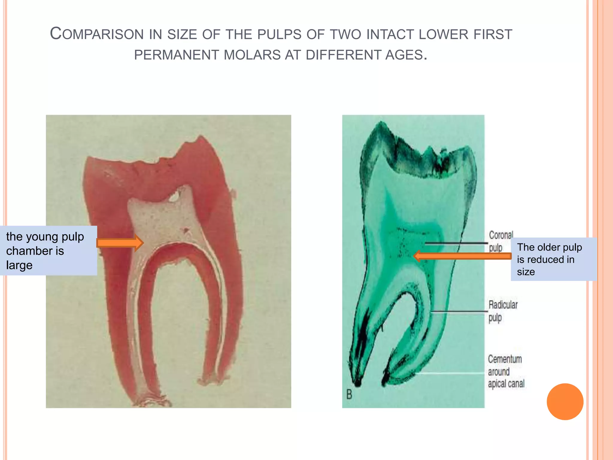 Pulp cavities | PPTX