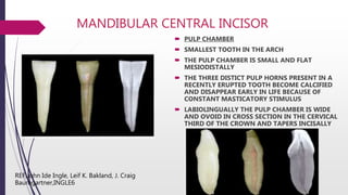 Pulp cavities of teeth | PPTX