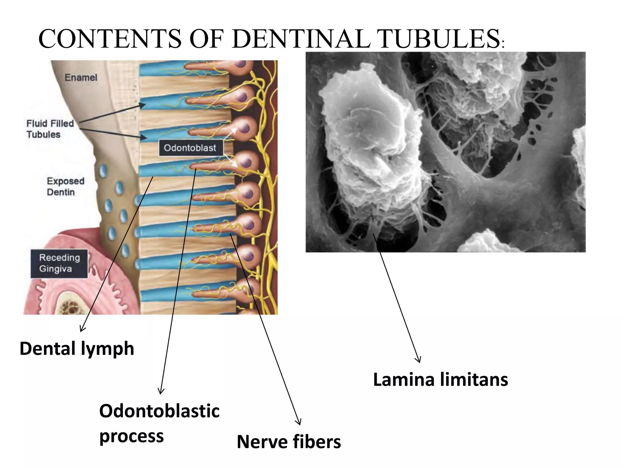 Pulp dentin complex | PPTX