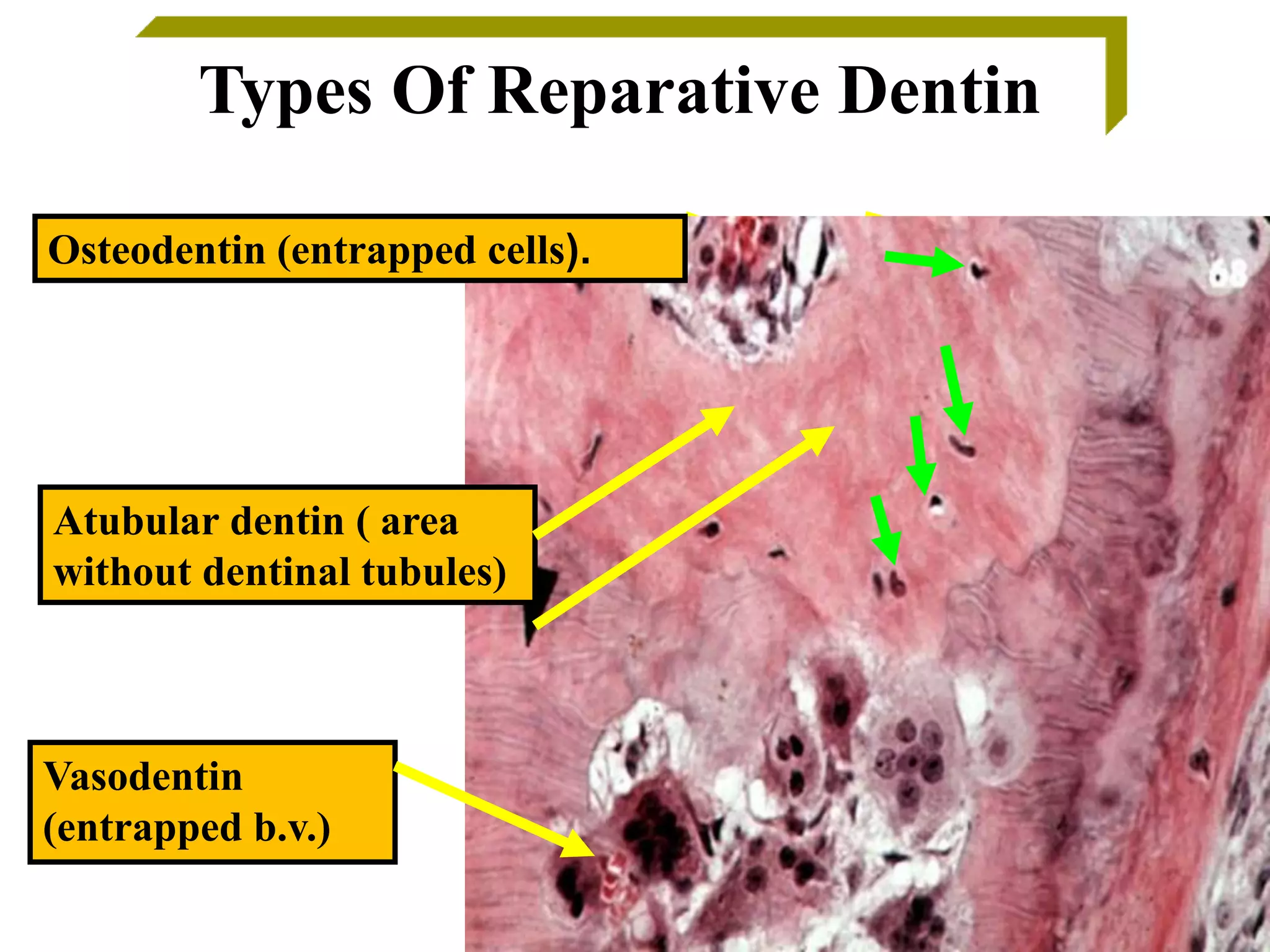 Pulp dentin complex | PPTX | Dental Health | Diseases and Conditions